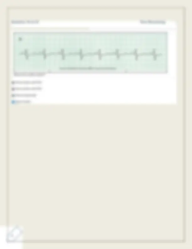 Relias Dysrhythmia Basic Test Answers: A Comprehensive Guide to Cardiac ...