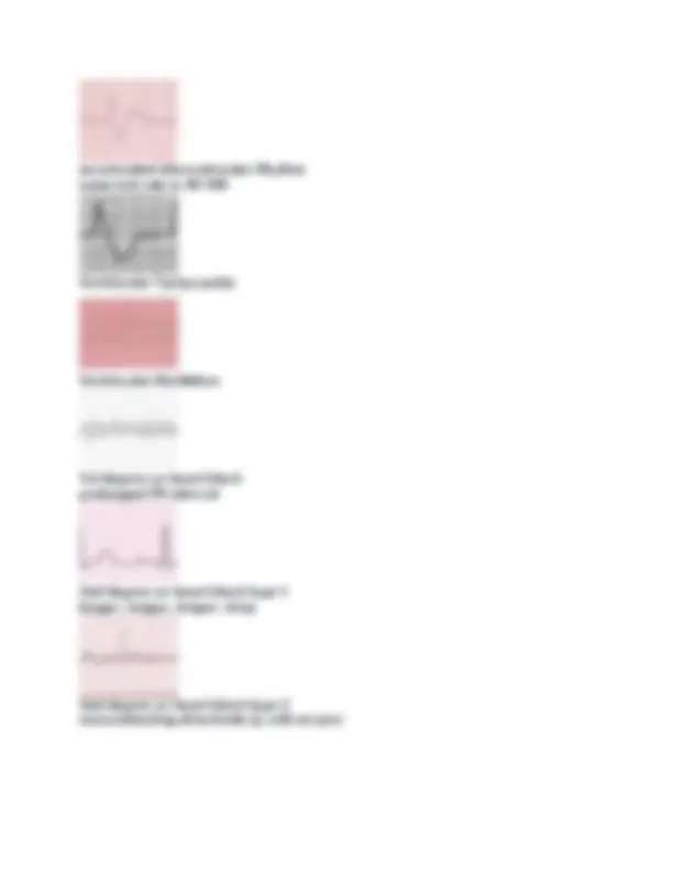 HCA ECG Test Exam With Answers 2024/2025 | Exams Nursing | Docsity