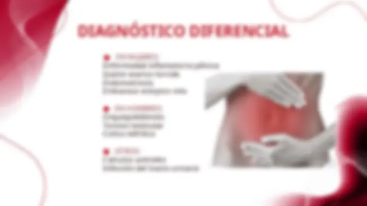 Apendicitis aguda y un pequeño articulo de apendicitis en el embarazo ...