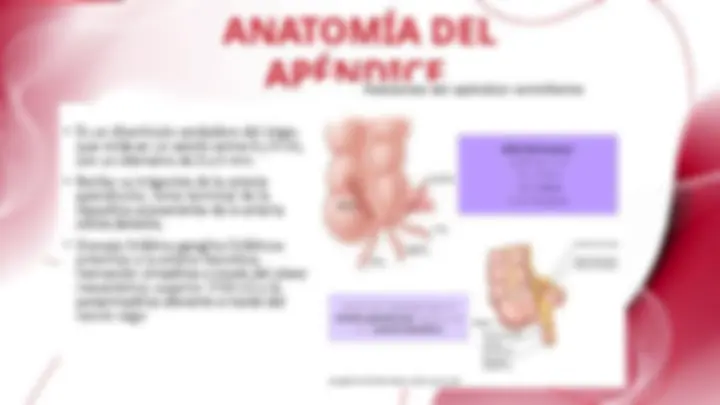 Apendicitis aguda y un pequeño articulo de apendicitis en el embarazo ...