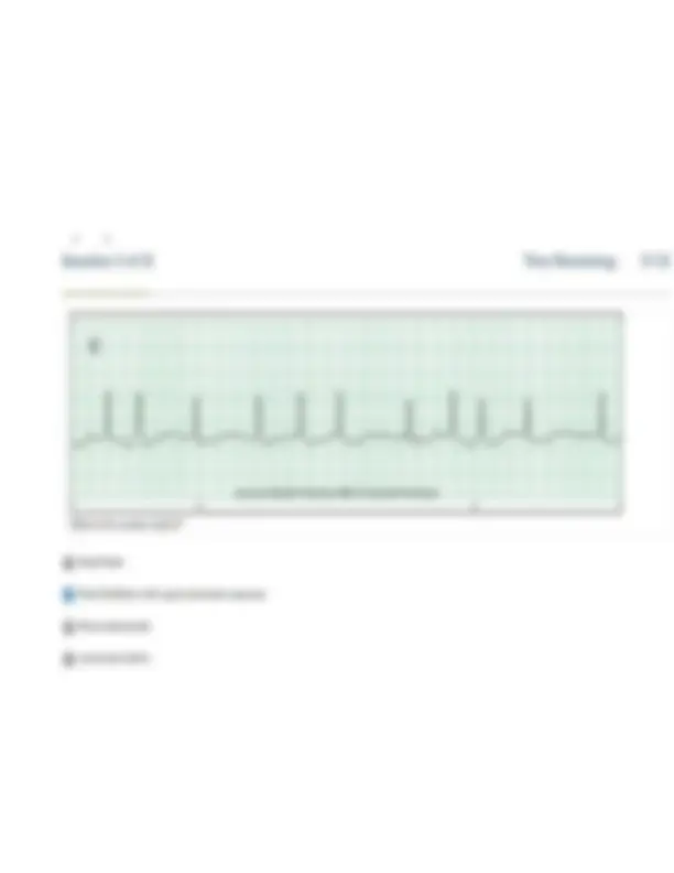 RELIAS DYSRHYTHMIA BASIC TEST (REVISED VERSION) A+ GRADED|35 CORRECT ...