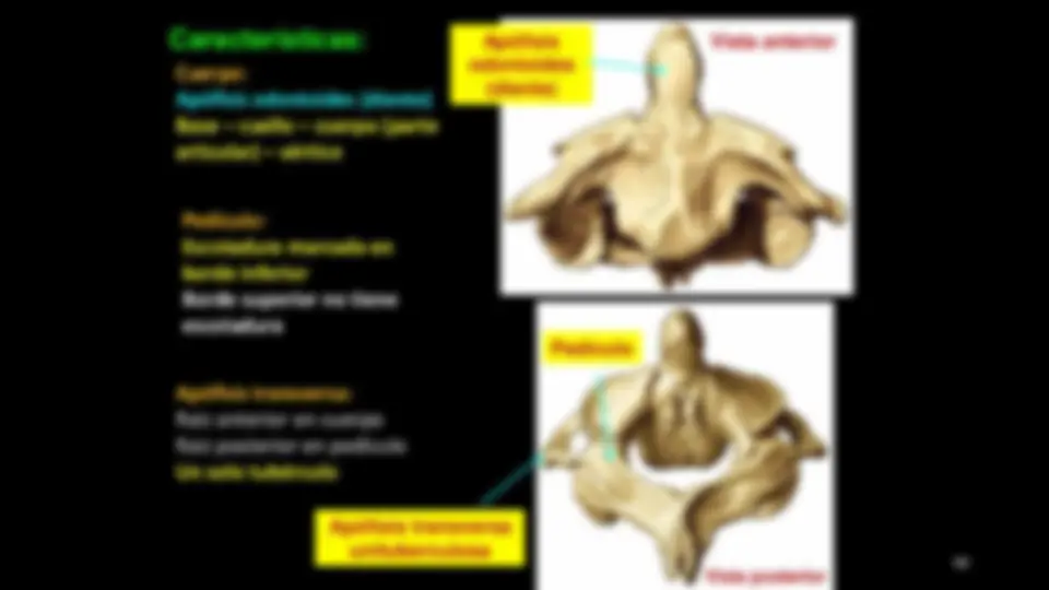 Anatomía del Cuello: Una Guía Completa con Imágenes y Explicaciones ...