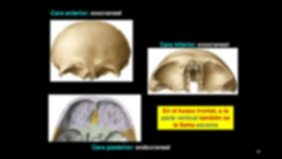Anatomía del Cuello: Una Guía Completa con Imágenes y Explicaciones ...
