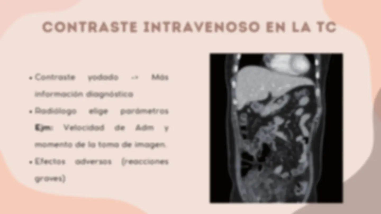 TOMOGRAFÍA NORMAL DE ABDOMEN Y PELVIS | Diapositivas de Imagenología | Docsity