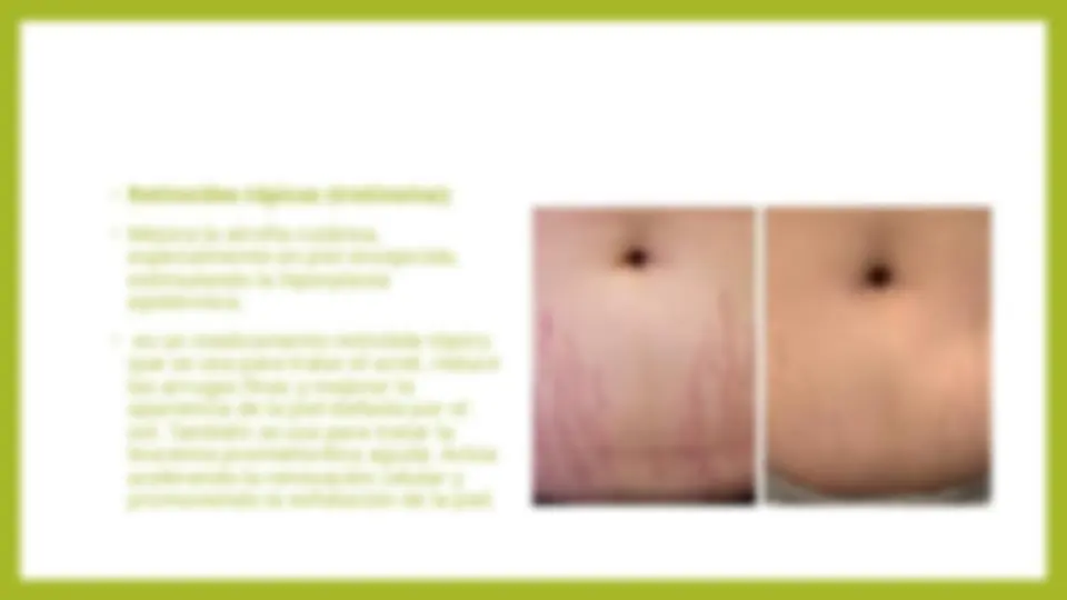 atrofia cutaneas en la piel | Lecture notes Law | Docsity