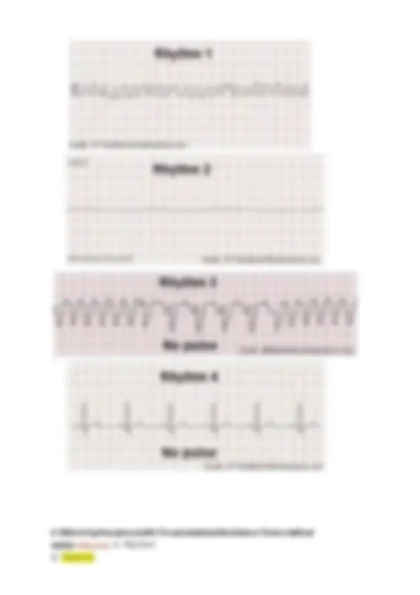 RELIAS DYSRHYTHMIA BASIC TEST 35 QUESTIONS AND ANSWERS (BASIC A ...