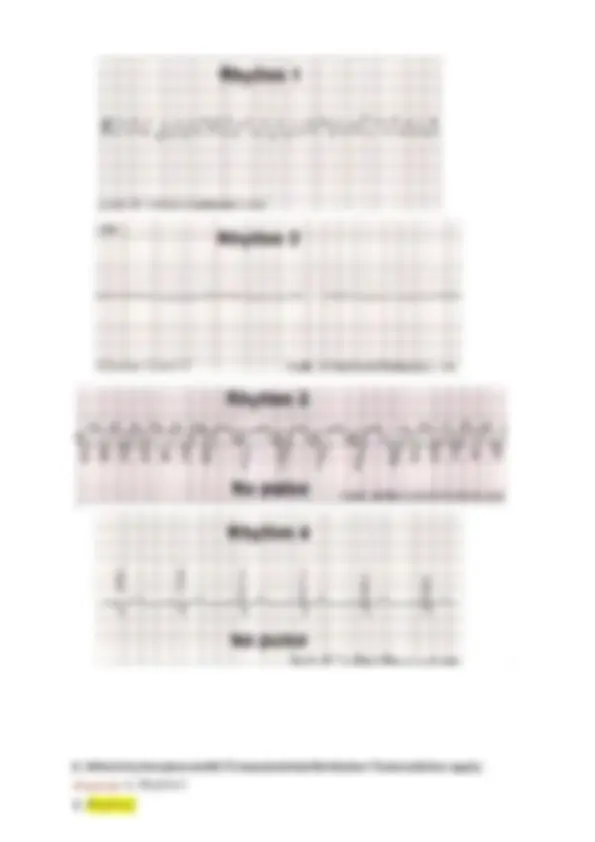 RELIAS DYSRHYTHMIA BASIC TEST 35 QUESTIONS AND ANSWERS (BASIC A ...