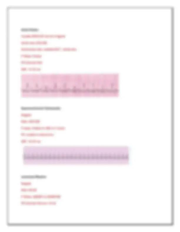 Cardiac Dysrhythmia Quick Reference Guide: ECG Interpretation | Exams ...