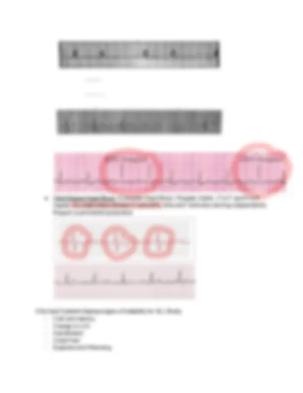 EKG Rhythm Strips and Cardiac Interventions Study Guide (Nursing ...