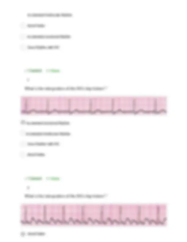 EKG Monitor Tech Certification Exam Questions and Answers | Exams ...