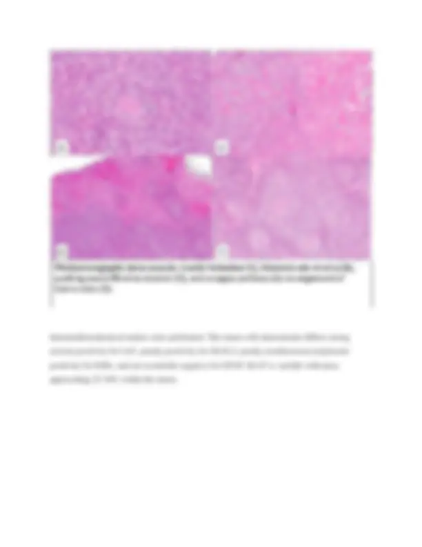 Ihuman case study Young Female with Insidious Onset of Severe Back Pain ...