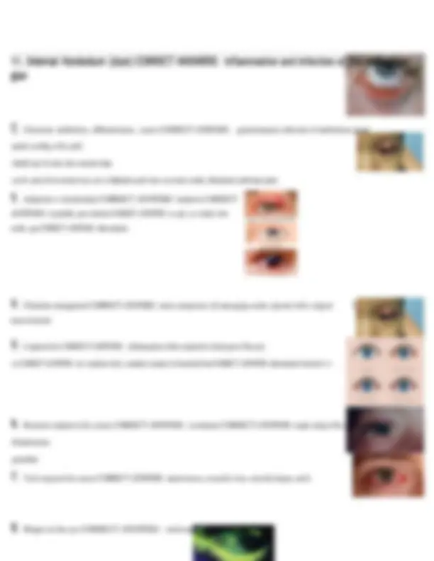 EENT Nursing Study Guide: Comprehensive Review of Eye, Ear, Nose, and ...