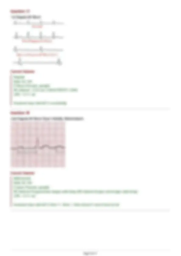 Relias Dysrhythmia Basic A (2025-2026 UPDATE) with 50+ Questions and ...