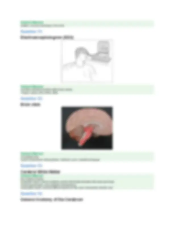 Principles of anatomy and physiology Tortora Derrickson chapter 14 ...