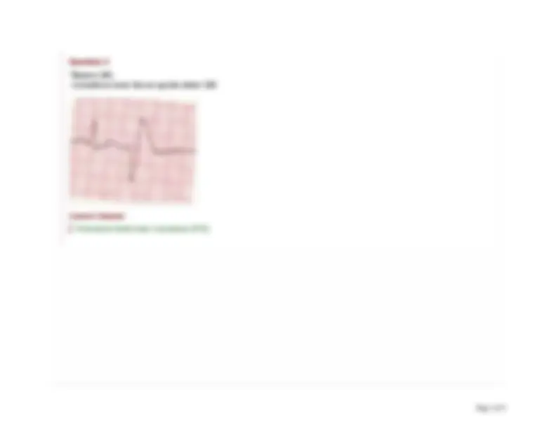 Baycare EKG Test Questions and Answers Fall 2026-2027 Update.pdf ...