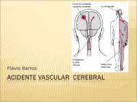 Tipos de AVC Acidente vascular cerebral - Docsity