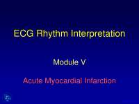 Acute Myocardial Infarction - ECG Rhythm Interpretation - Lecture ...