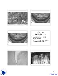 Epulis Fissuratum - Oral and Maxillofacial Pathology - Lecture Slides ...