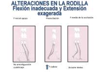 Marcha Patológica - Apuntes-Analisis de Movimiento - Parte2 - Docsity