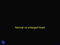 Normal vs Enlarged Heart - Radiology Lab - Lecture Slides - Docsity