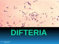 Difteria power point - DIfteria, o que é, sinais/sintomas e tratamento ...