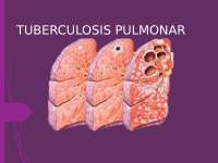 Tuberculosis pulmonar - Docsity