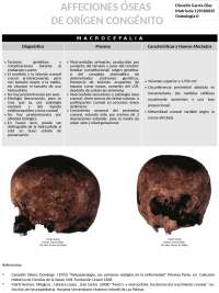 Macrocefalia, origen y desarrollo - Docsity