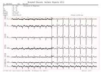 ELECTROCARDIOGRAMA NORMAL - Docsity