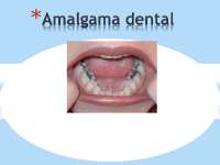 Amalgama dental y su uso en odontologia contemporanea - Docsity