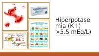 Hiperpotasemia (hiperkalemia) en urgencias - Docsity