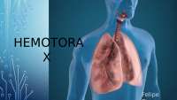 Hemotorax semiologia - Docsity