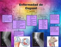 ENFERMEDAD DE OSGOOD - Docsity