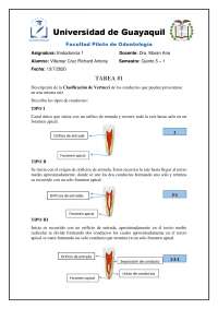 CLASIFICACIÓN DE VERTUCCI | Apuntes de Endodoncia | Docsity