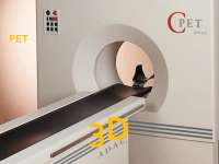 Tomografía por emisión de positrones 3d - Docsity