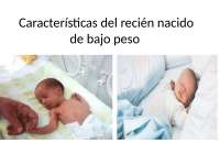 Características-del-recién-nacido-de-bajo-peso - Docsity