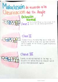 Clasificación de Angle - Docsity