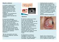 MIOSITIS ORBITARIA ENFERMEDAD INFLAMATORIA - Docsity