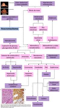 Algoritmo de Feocromocitoma | Esquemas y mapas conceptuales de ...