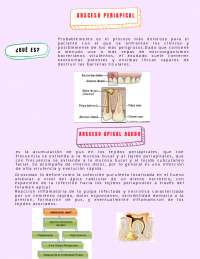 ABSCESOS PERIAPICALES - Docsity