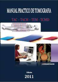 Manual practico de tomografia - Docsity