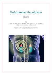 Enfermedad de Addison. - Docsity