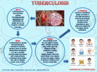 Infografía Tuberculosis - Docsity