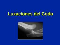 Luxación de codo valoracion, tratamiento y tipos - Docsity