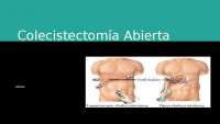 Colescistectomia abierta - Docsity