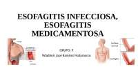 Esofagitis infecciosas - Docsity