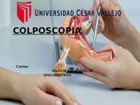 COLPOSCOPÍA - Resultados normales y anormales - Docsity