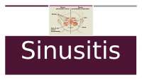 Sinusitis en pediatría - Docsity