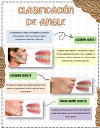 Clasificación de Angle - Docsity