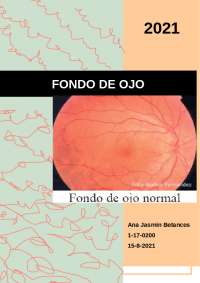 FONDO DEL OJO NORMAL - Docsity