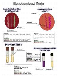 Biochemical Test Notes - Docsity